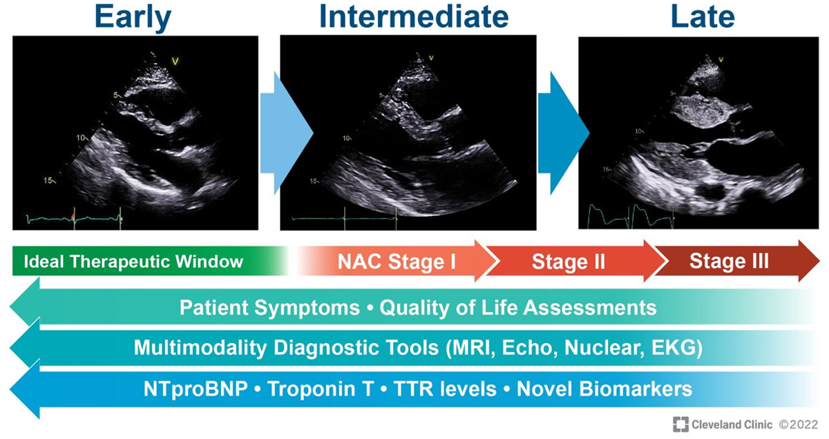 Lesson 1: Step 5 – Staging and Prognostication - CRK Courses